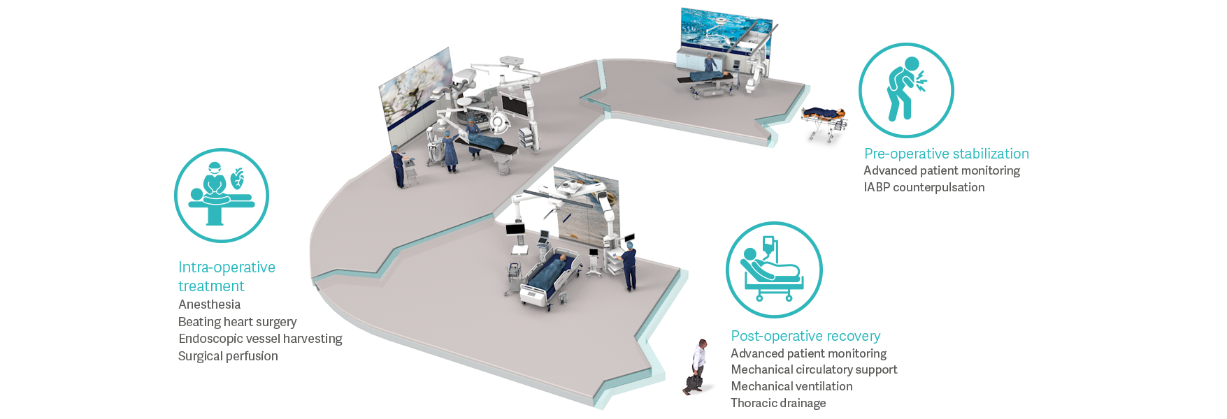 CABG - Coronary Artery Bypass Graft - Getinge
